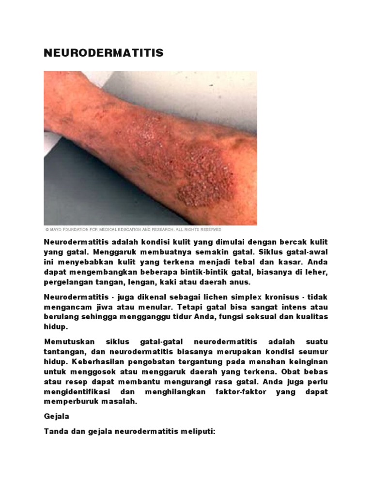 Neurodermatitis: Gejala dan Pengobatan | PDF