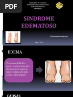 Edema y Signo de Godet | PDF | Edema | Especialidades Medicas