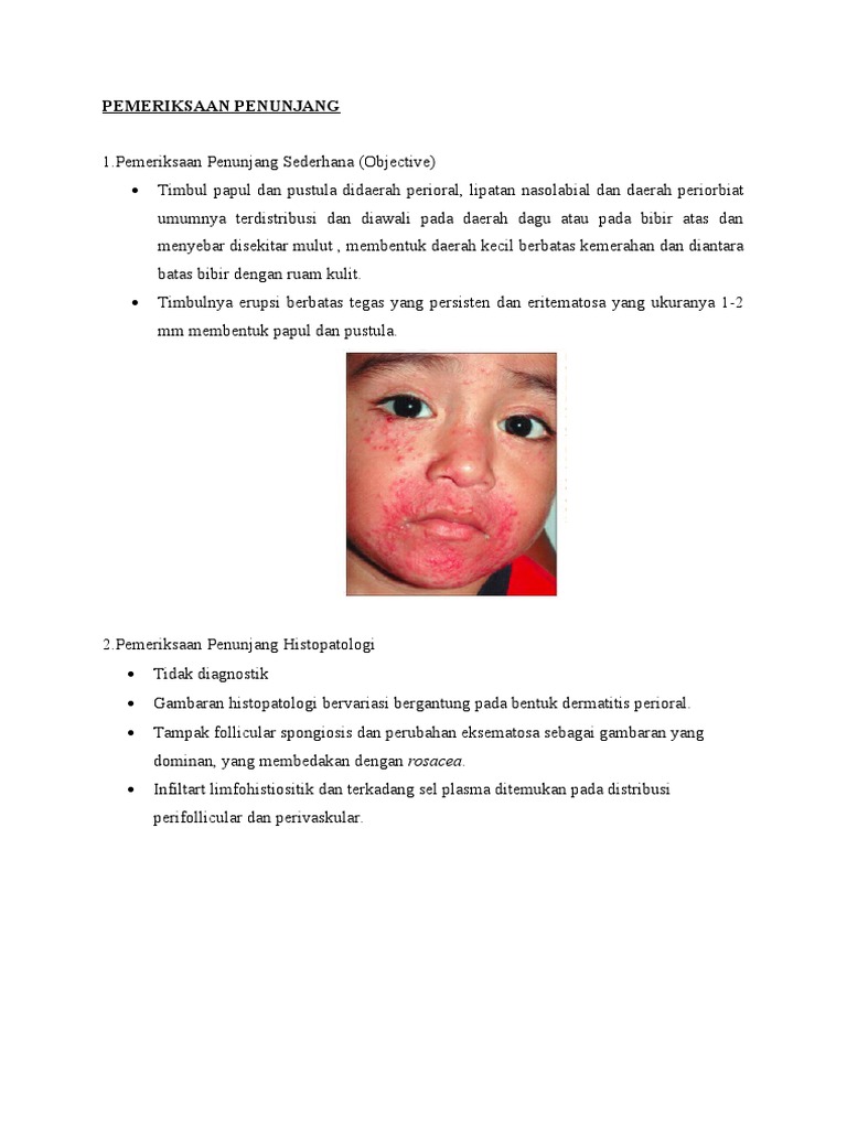 Pemeriksaan Penunjang Dermatitis Perioral | PDF