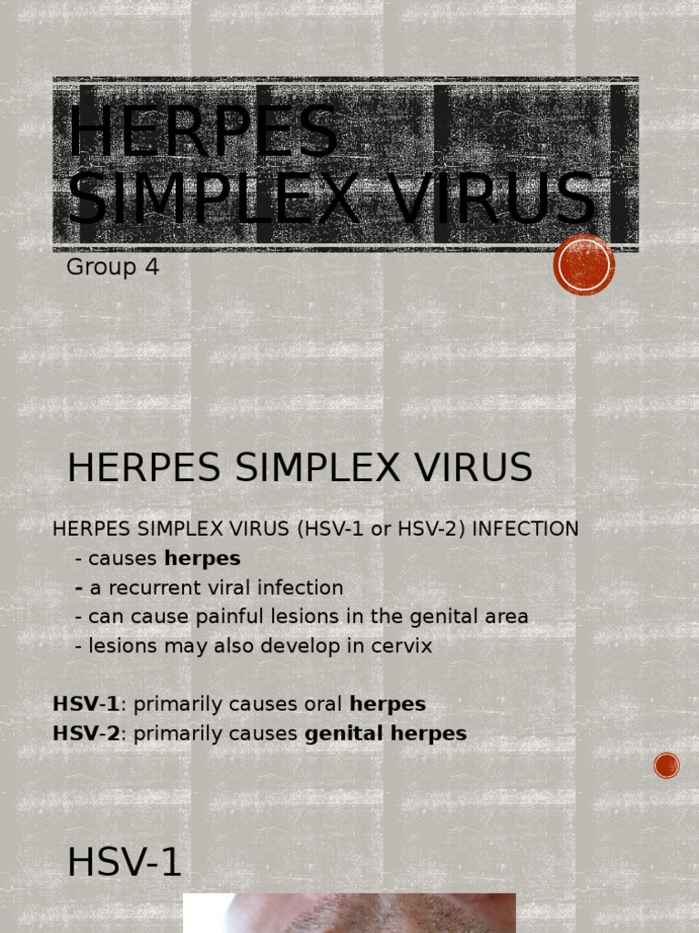 Herpes Simplex Virus | PDF | Herpes Simplex | Microbiology