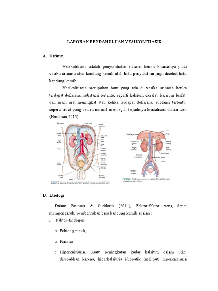 LP Vesikolitiasis | PDF