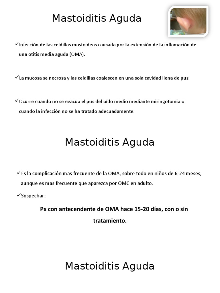 Mastoiditis Aguda | PDF | Ciencia y matemáticas