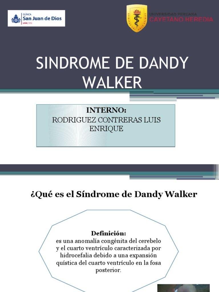 Sindrome de Dandy Walker | PDF | Medicina CLINICA | Especialidades Medicas