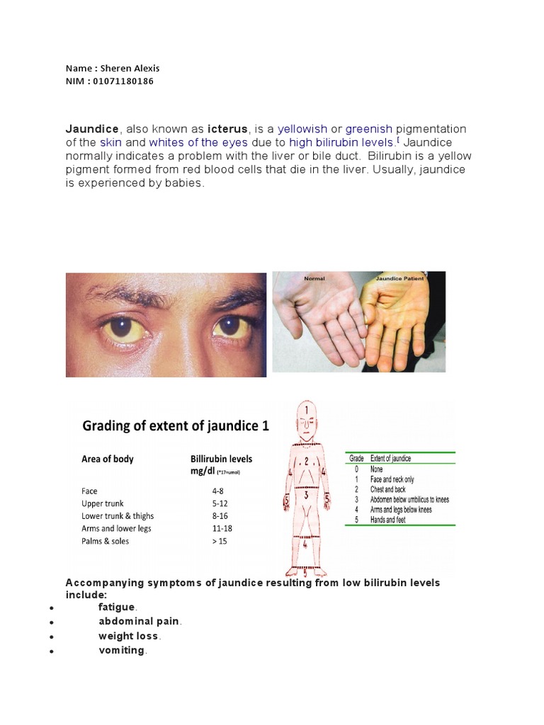 Jaundice | PDF | Liver | Anatomy