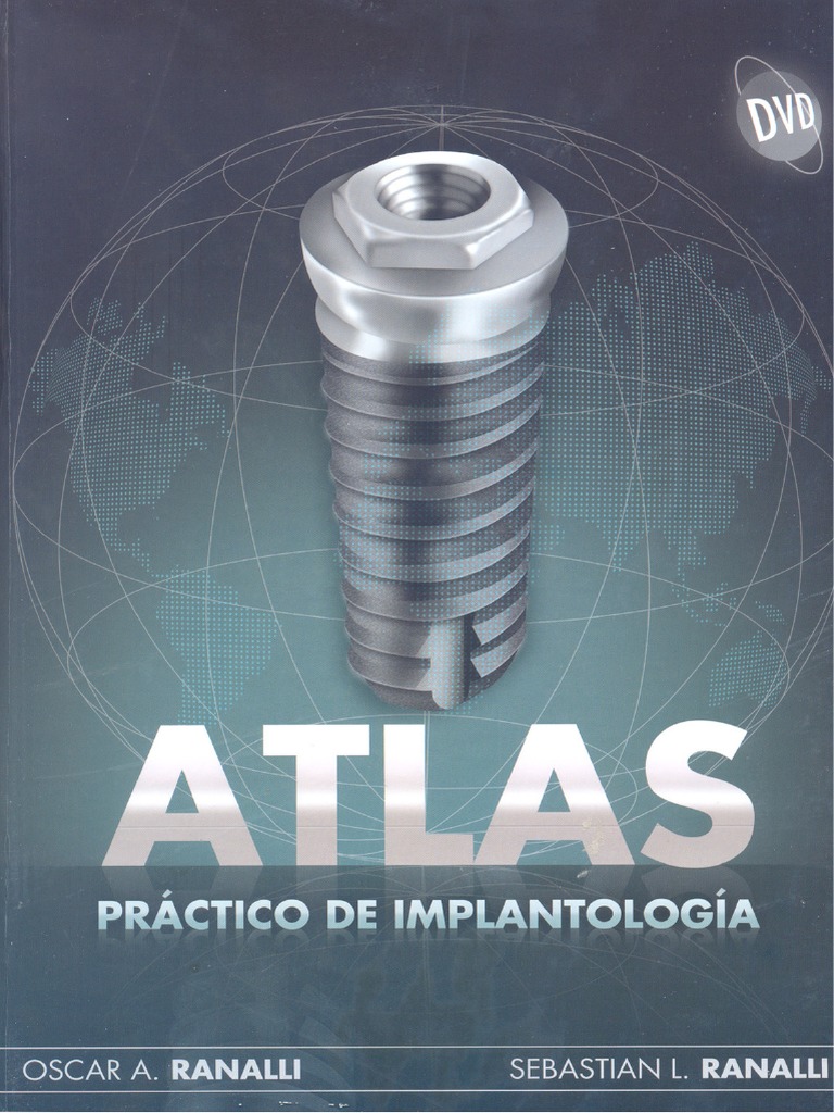 Atlas Practico de Implantologia PDF | PDF Atlas Practico de Implantologia PDF | PDF