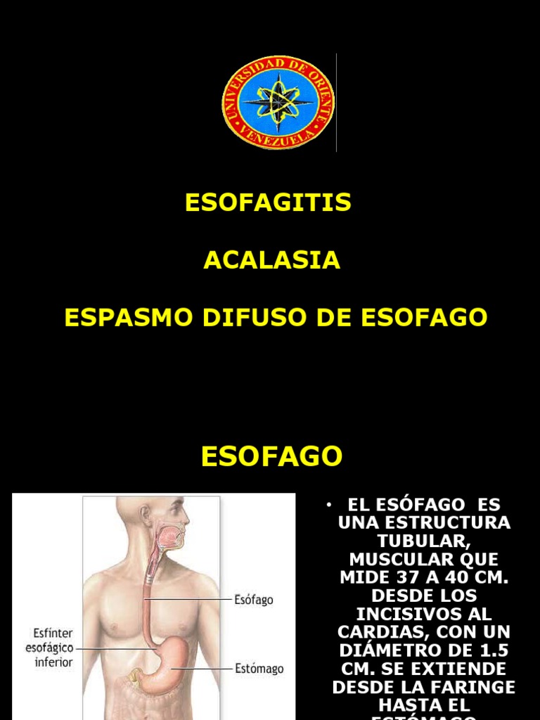 ESOFAGITIS | PDF | La enfermedad por reflujo gastroesofágico | Esófago