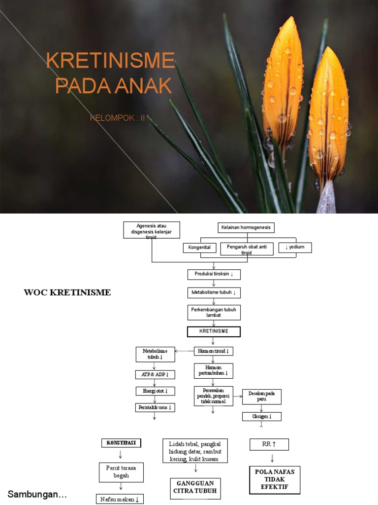 Kretinisme Pada Anak | PDF