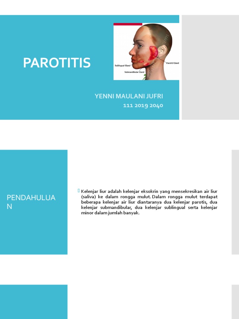 PAROTITIS | PDF
