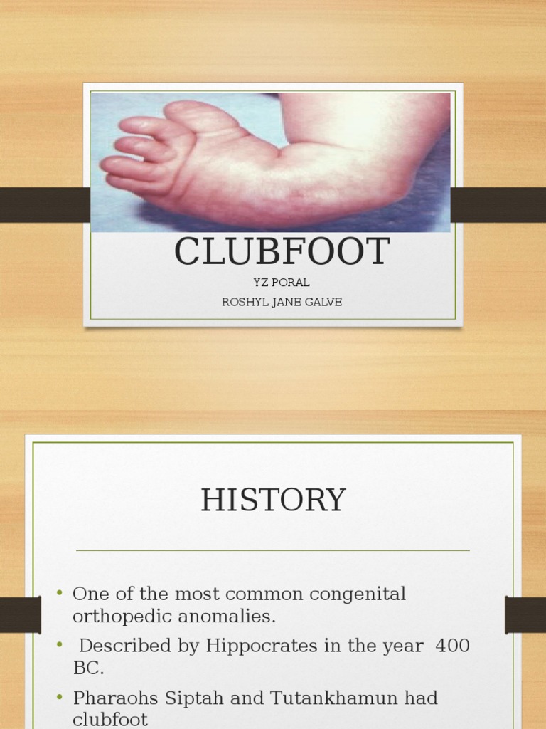 CLUBFOOT | PDF | Diseases And Disorders | Musculoskeletal System