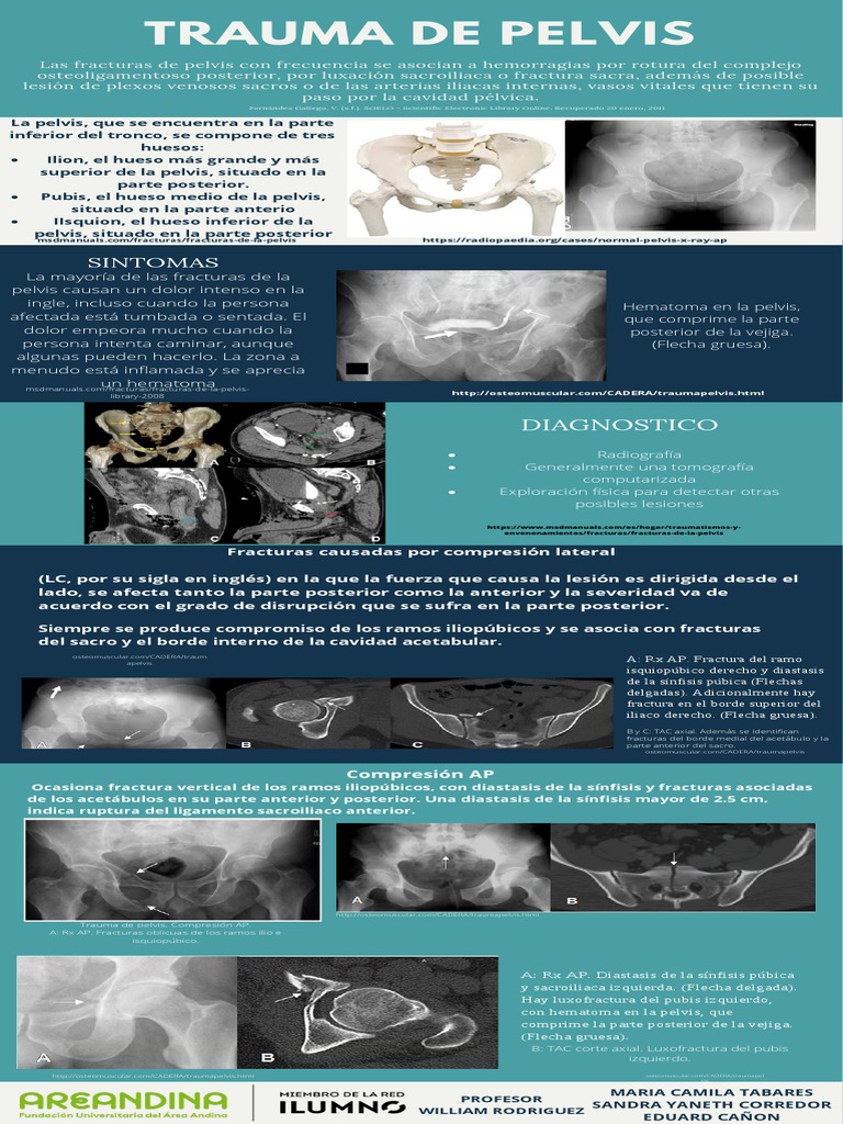 Trauma de Pelvis | PDF | Pelvis | Anatomía