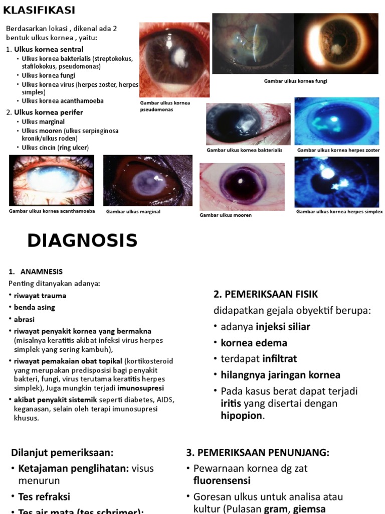 Klasifikasi Ulkus Kornea | PDF