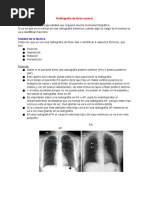 Ejemplo RX Torax Normal | PDF