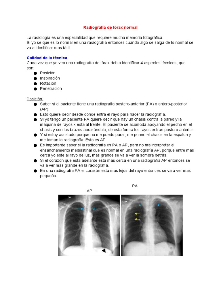 Radiografia Normal de Torax | PDF | Pulmón | Corazón