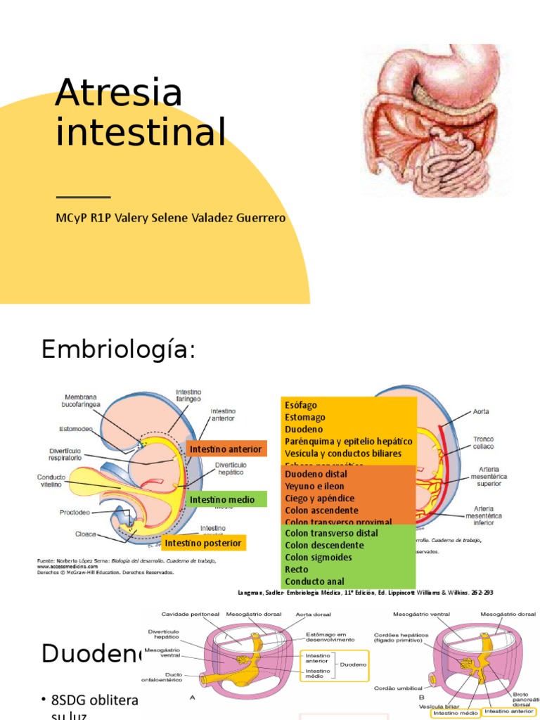 Atresia Intestinal | PDF | Intestino grueso | Abdomen