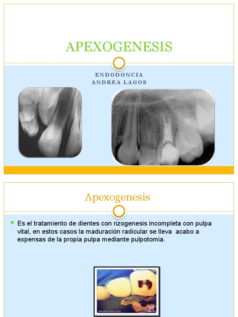 APEXOGENESIS | PDF | Especialidades Medicas | Medicina CLINICA