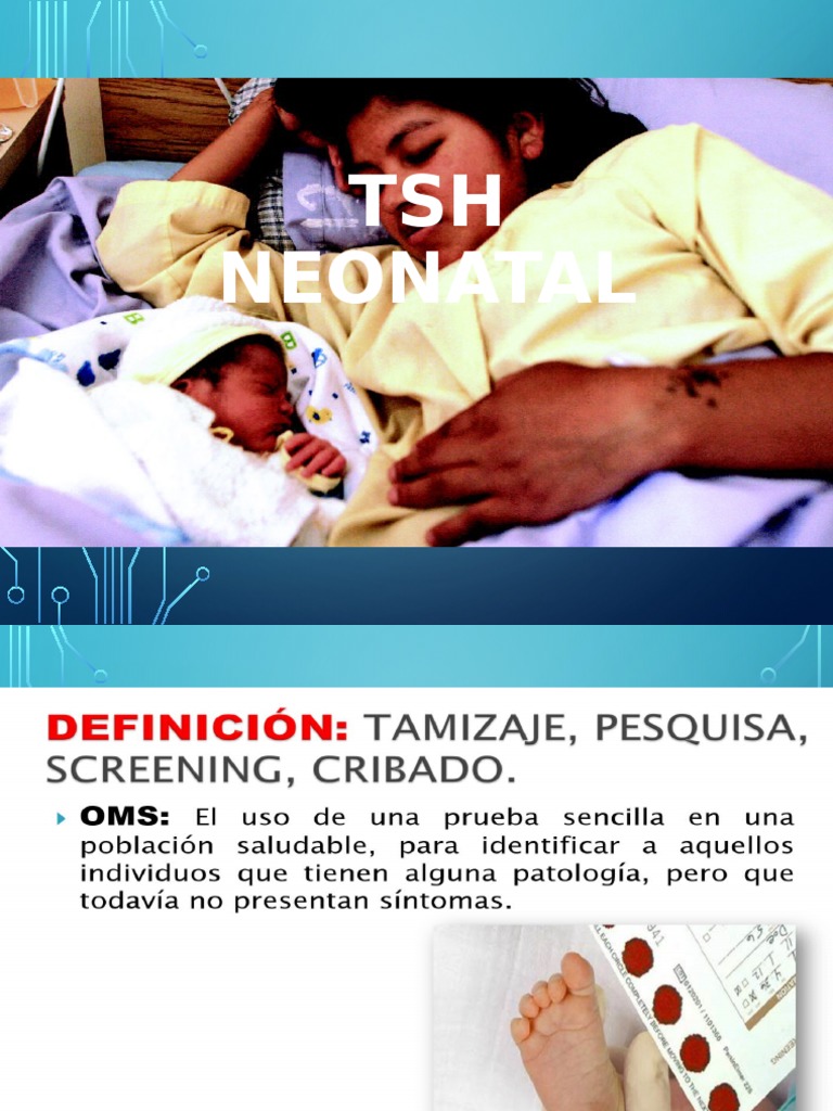 TSH Neonatal | PDF