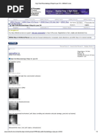 High Yield Surgery | PDF | Crohn's Disease | Breast Cancer