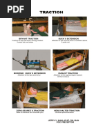 Balanced Skeletal Traction Procedure Guide | PDF | Clinical Medicine
