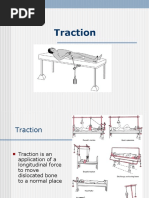 Gallows Traction Fact Sheet | PDF