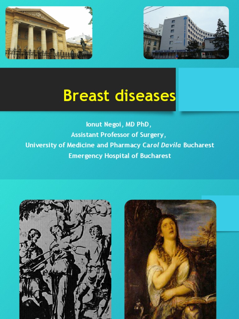 22.2017 Breast Diseases Lecture An 4 IN | PDF | Breast Cancer | Biopsy