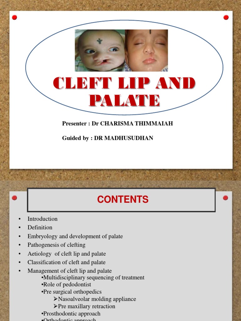Cleft Lip and Palate Seminar Ed PDF | PDF | Genetic Disorder | Human Nose