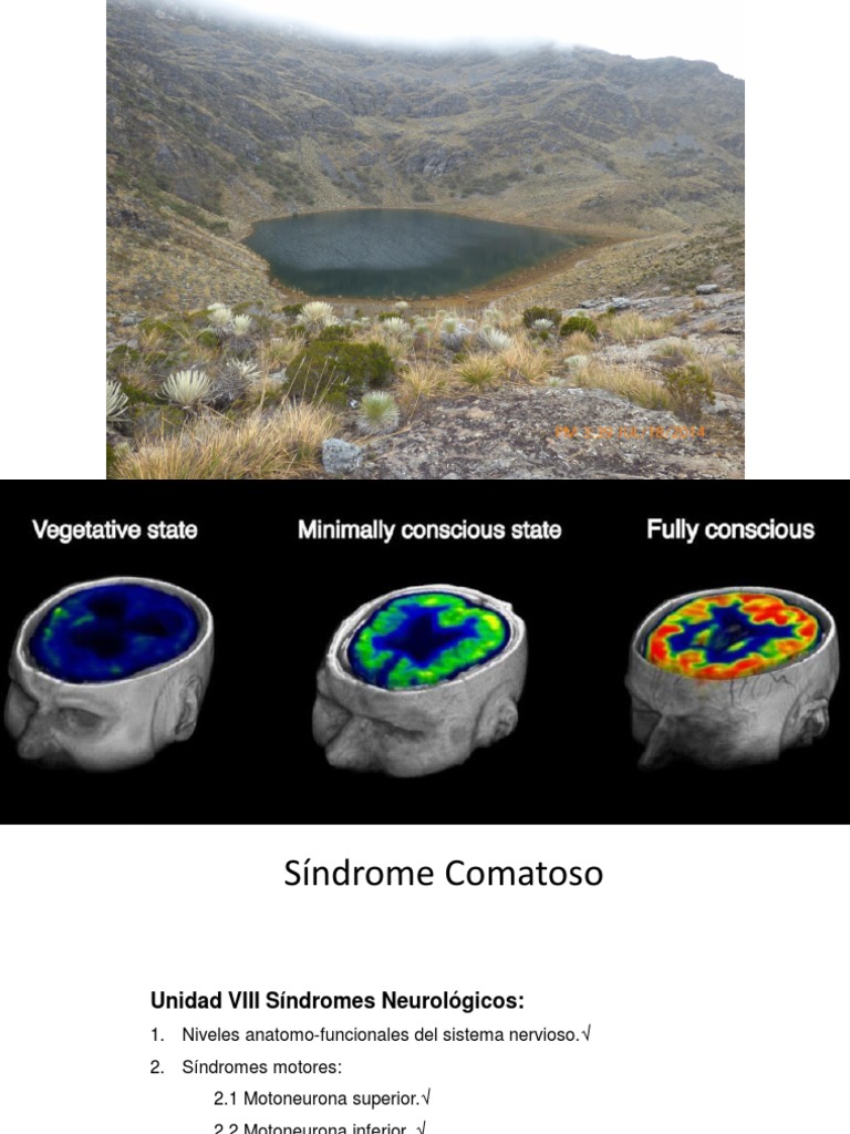 Síndrome Comatoso: Evaluación y Causas | PDF | Coma | Carrera