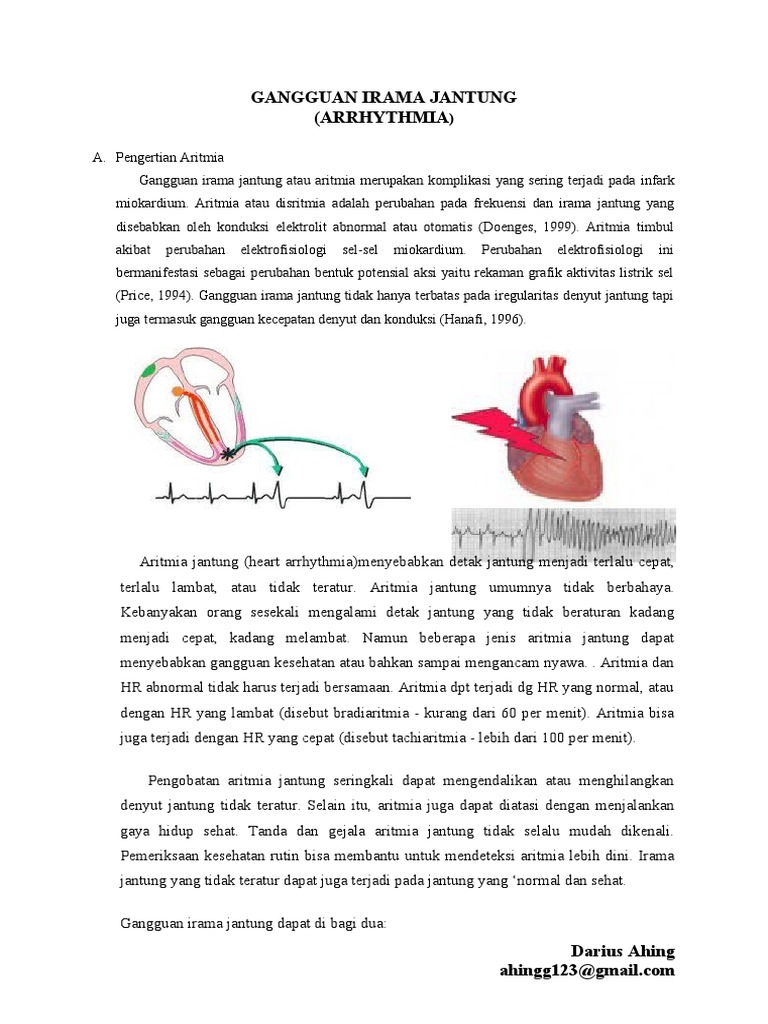 Gangguan Irama Jantung Arrhythmia | PDF