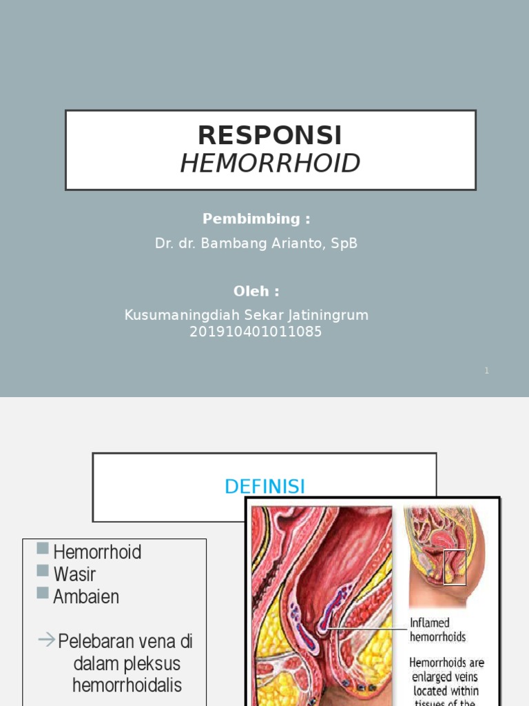 Hemorrhoid PPT | PDF