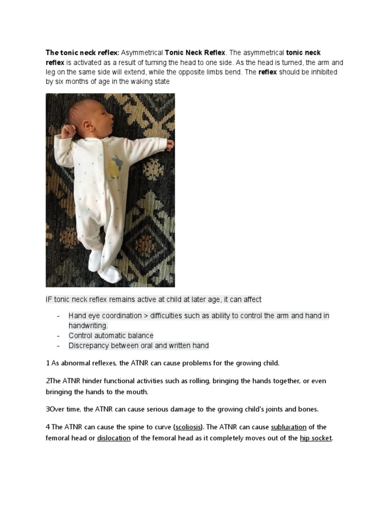 The Tonic Neck Reflex | PDF