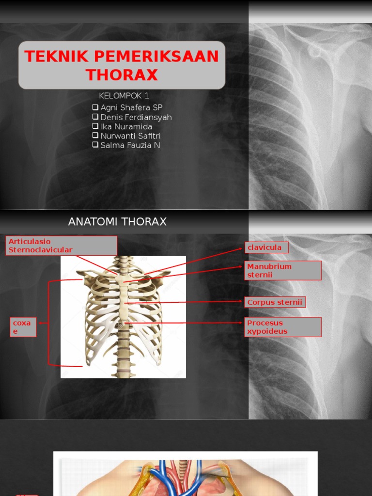 Thorax | PDF | Sains & Matematika