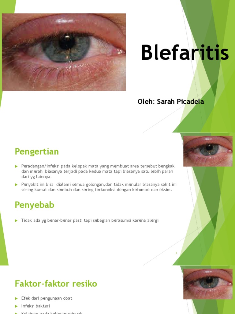 Blefaritis | PDF | Kesehatan Holistik