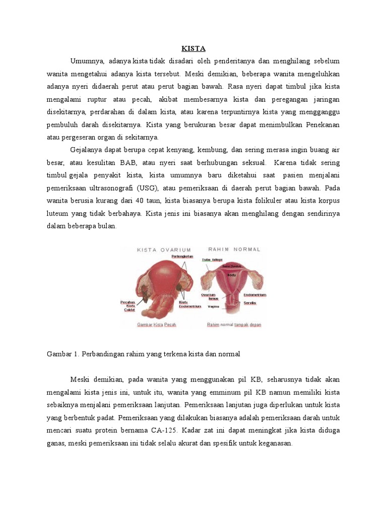 Definisi Kista & Macam Kista Lengkap | PDF | Kesehatan Holistik