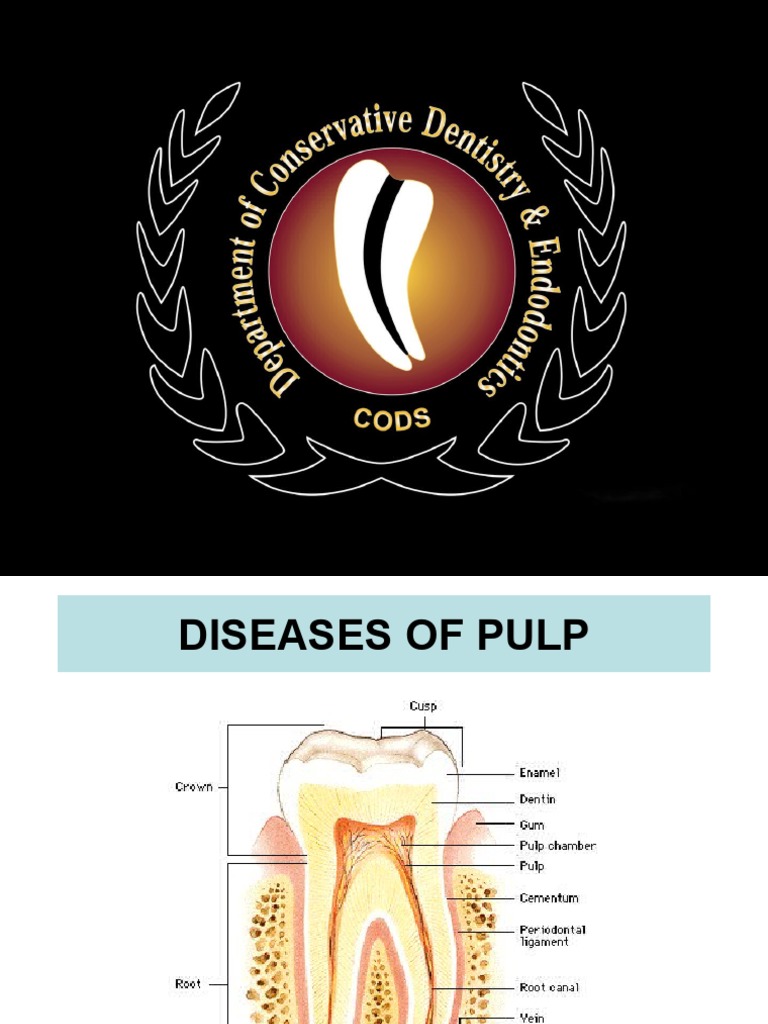 Diseases of Pulp | PDF | Health Sciences | Mouth
