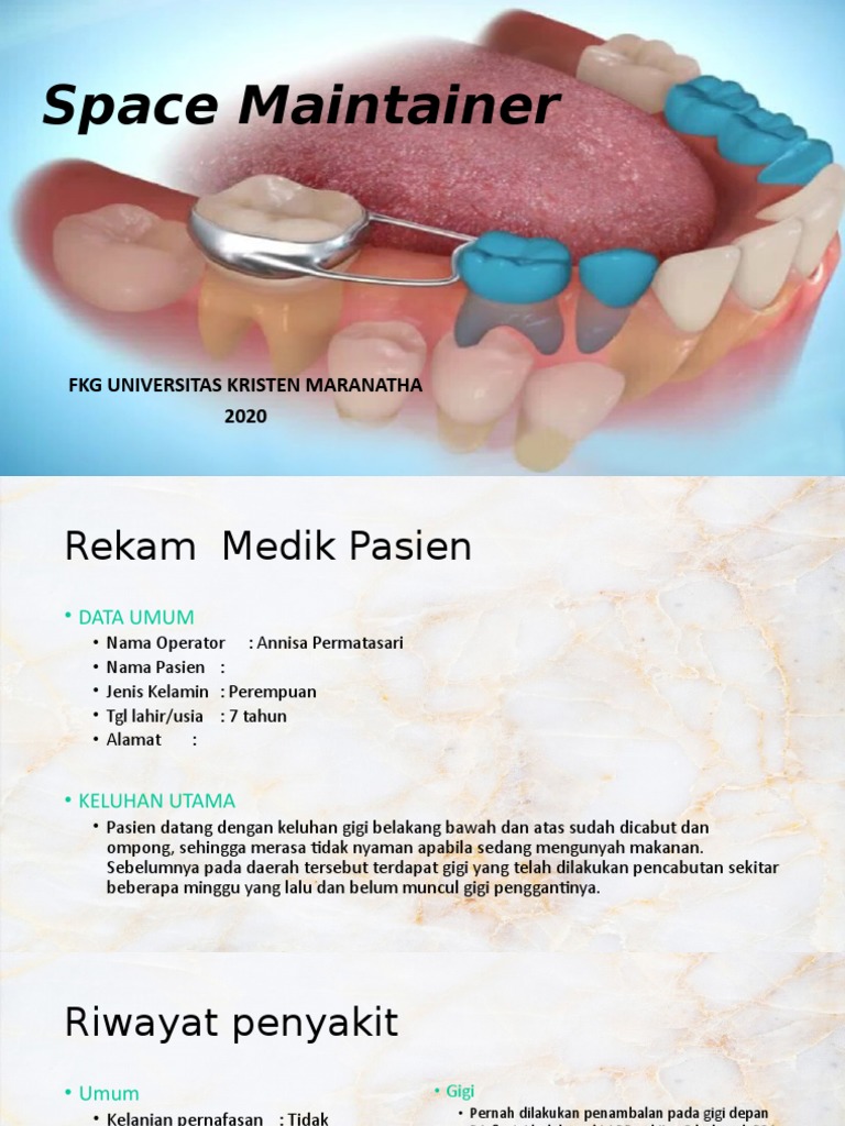 Space Maintainer | PDF