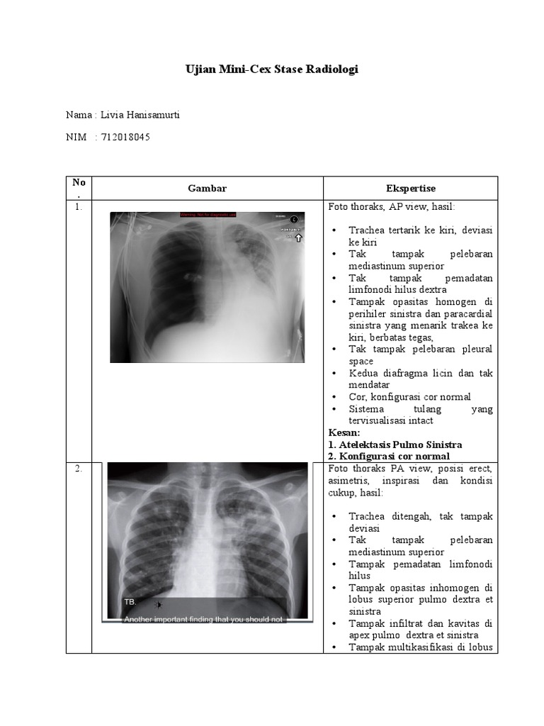Soal Radiologi | PDF
