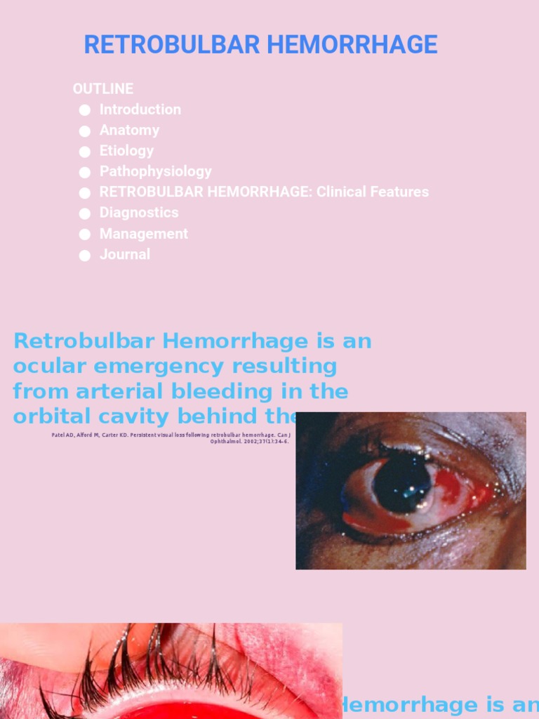 Retrobulbar Hemorrhage | PDF | Retina | Ischemia