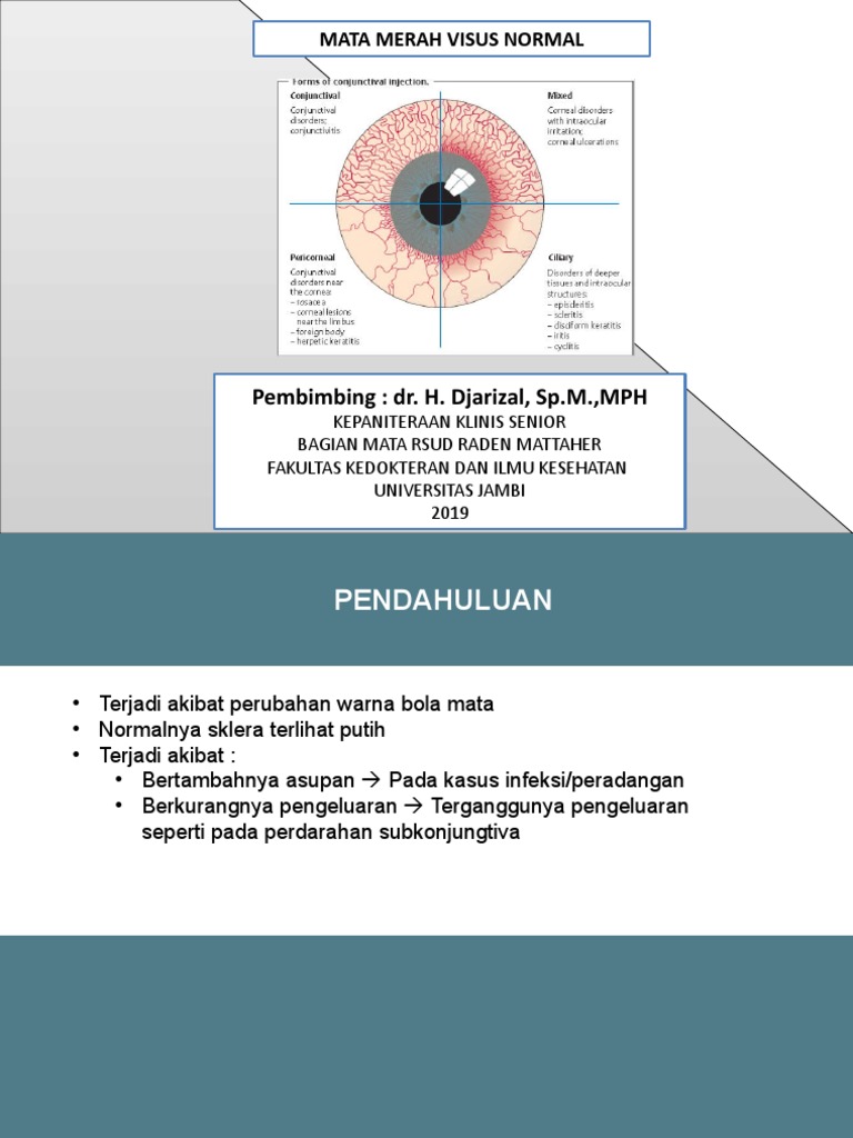 Mata Merah Visus Normal Fix | PDF