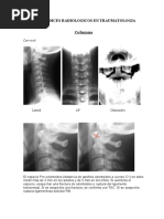 Diferencias Entre Meary y Costa Bartani | PDF | Pie | Sistema ...