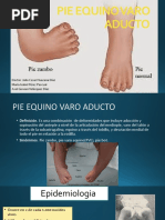 Pie Talo, Pie Varo, Valgo, y Pie Plano | PDF | Pie | Tobillo