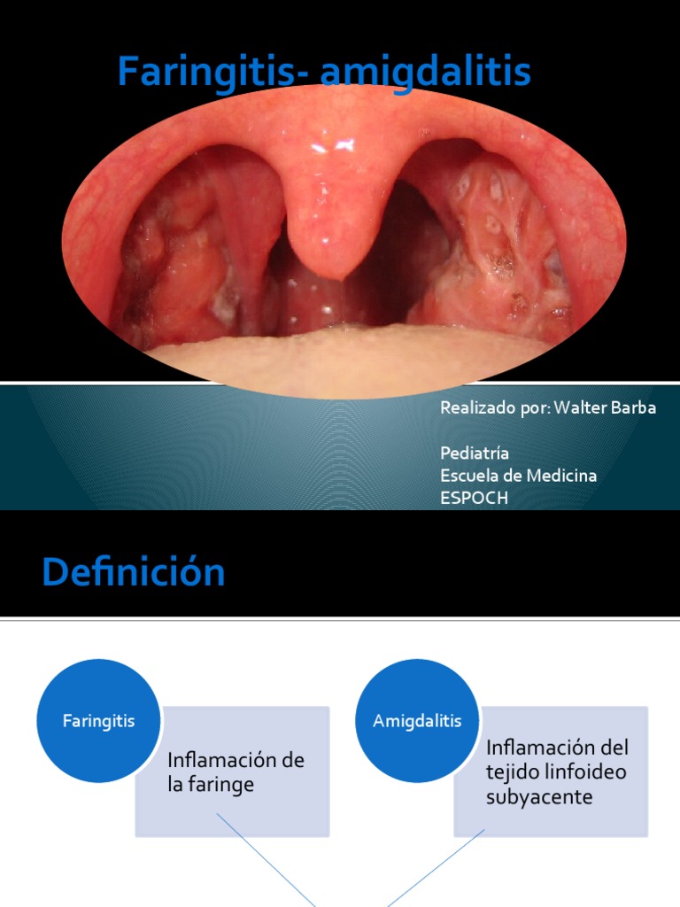Faringitis - Amigdalitis | PDF | Estreptococo | Microbiología