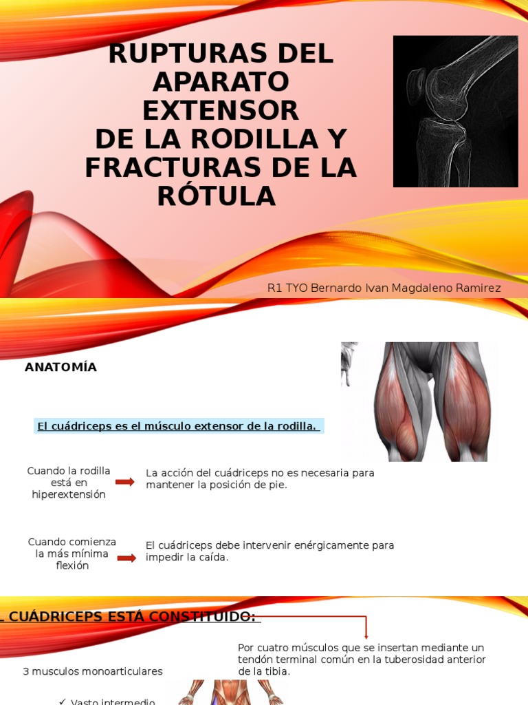 Rupturas Aparato Extensor de La Rodilla | PDF | Rodilla | Anatomía del ...