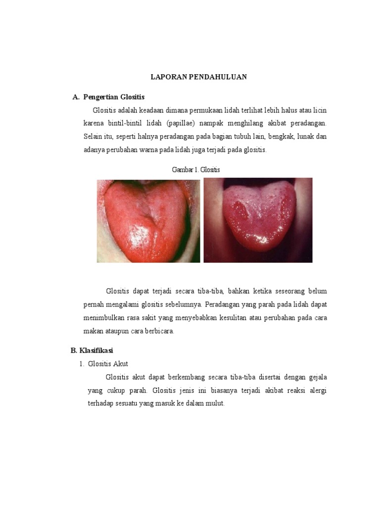 Glositis | PDF