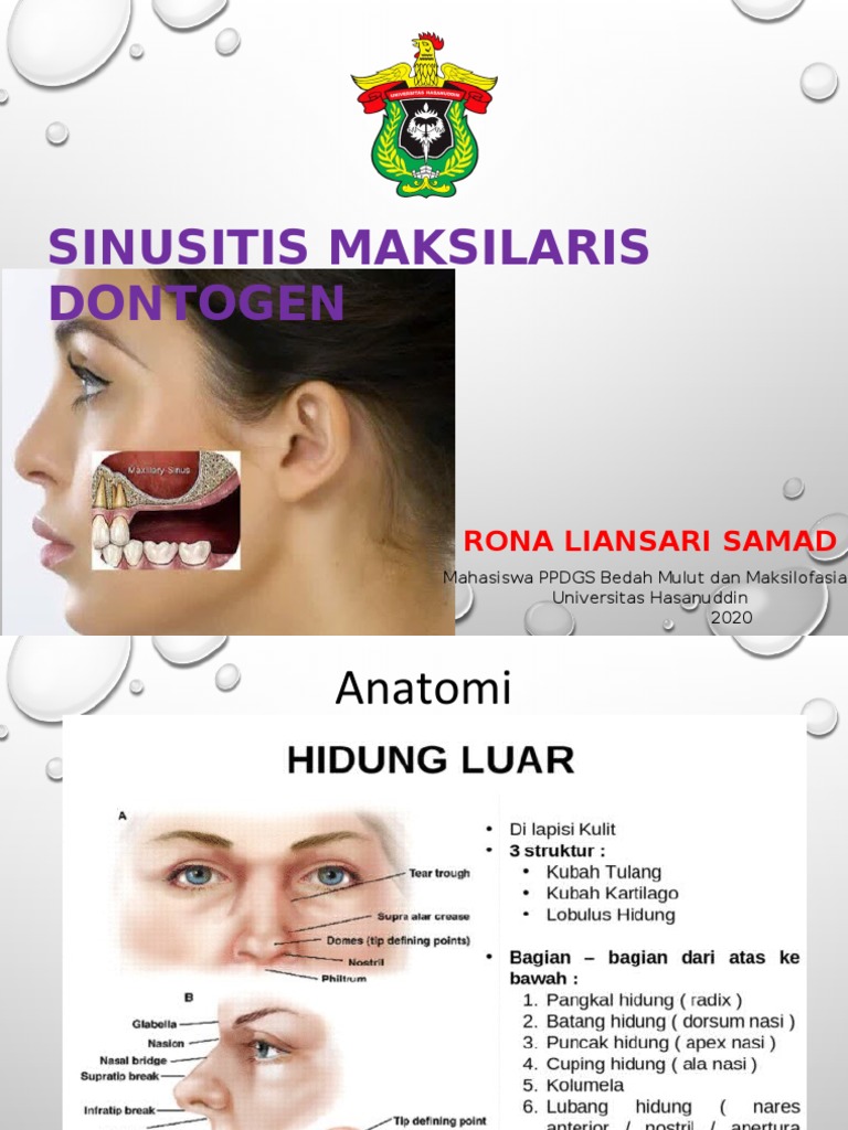 Sinusitis Maksilaris Dentogen: Diagnosis dan Pengobatan | PDF