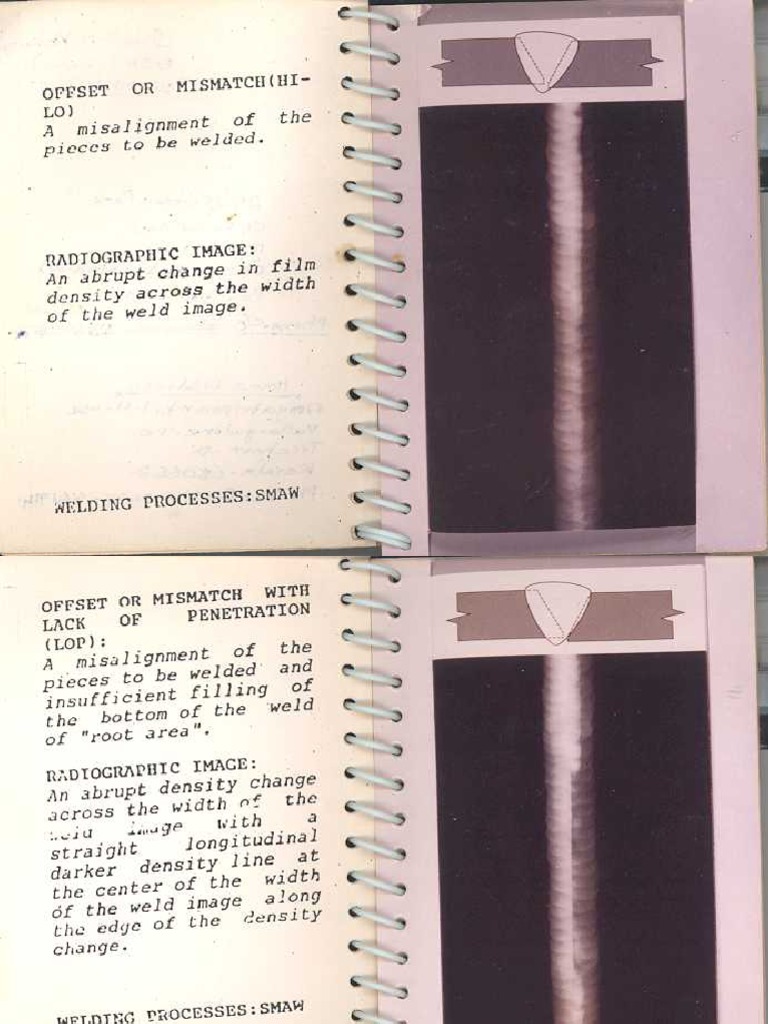 Reference Radiograph