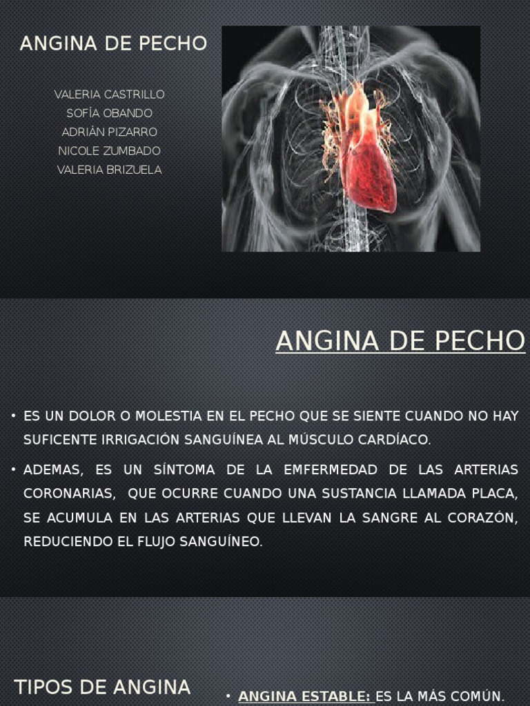 Angina de Pecho: Síntomas y Tratamientos | PDF