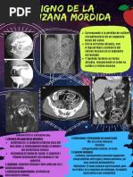 Niveles Axilares de Berg | PDF | Finanzas y administración del dinero