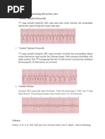 Siriraj Stroke Score | PDF