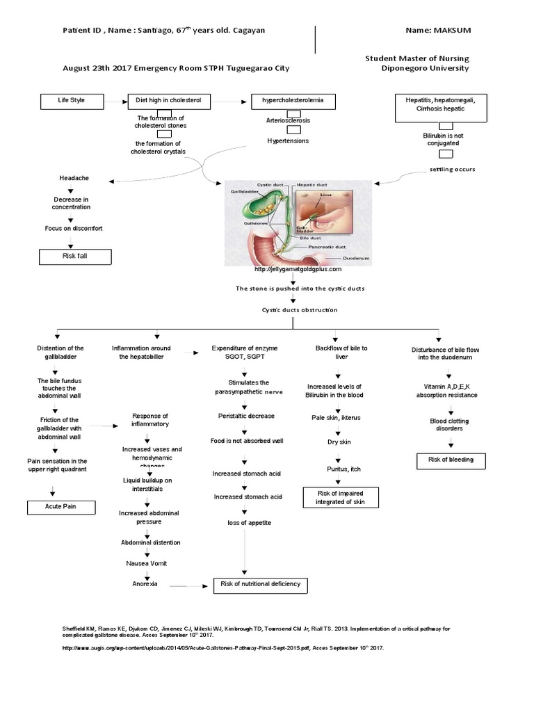 Mind Map Gallstones | PDF | Gallbladder | Bile