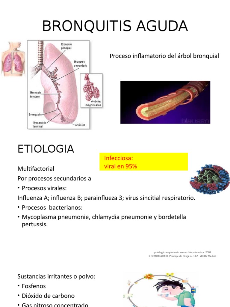 Bronquitis Aguda | PDF | Epidemiología | Salud pública