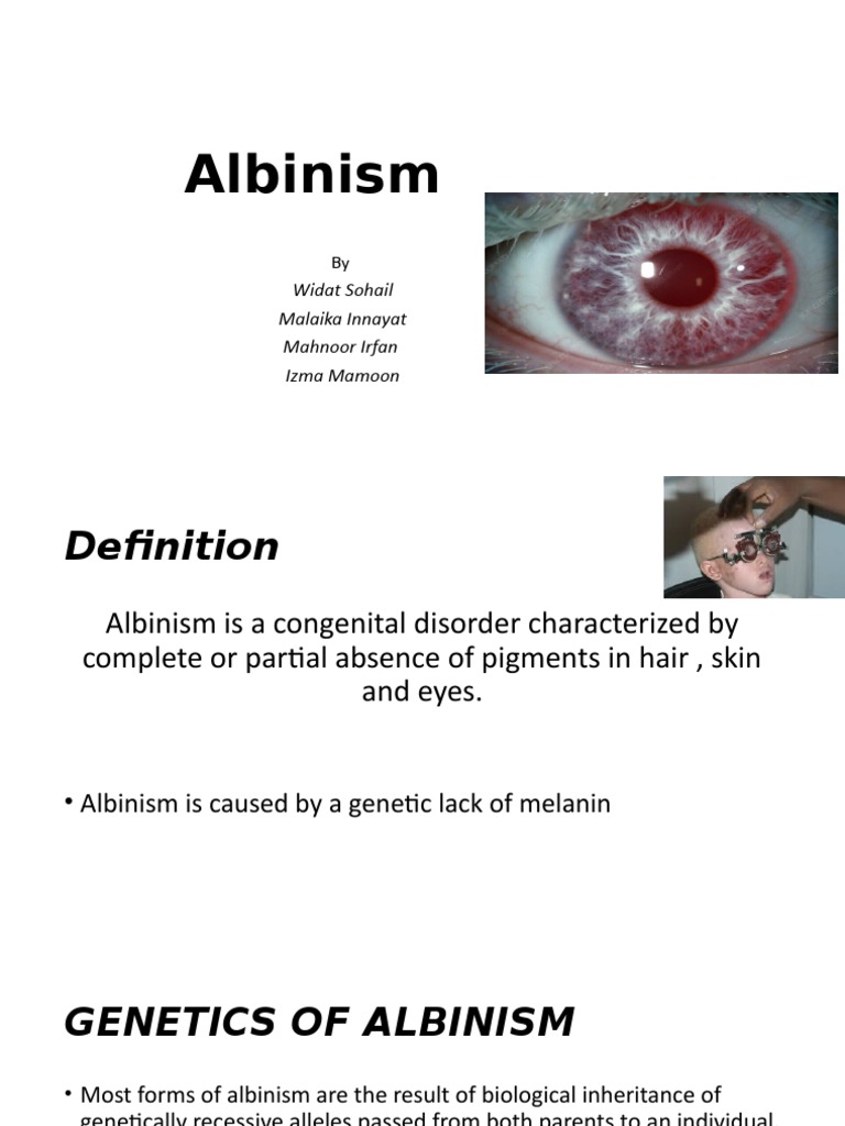 Albinism | PDF | Genetics | Biology